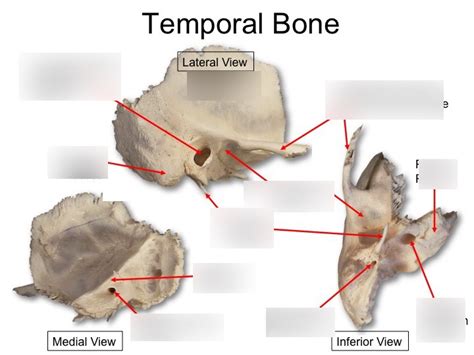 Temporal Bone Diagram Quizlet