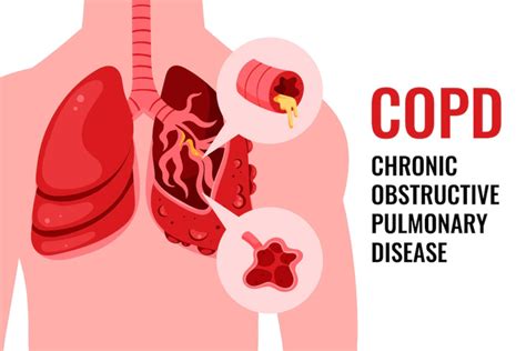 World COPD Day 2022 Theme Quotes Images Wishes Messages Slogans