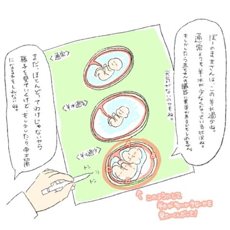 羊水の検索結果 Yahooきっず検索