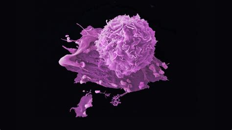 Research Uncovers How To Target ‘sleeping Breast Cancer Cells And