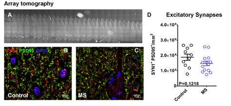 Fig S2 A Example Of An Array Tomography At Ribbon Image Taken