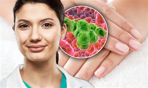 Cancer Symptoms Signs Of Tumours And Skin Melanoma In Your Nails Express Co Uk