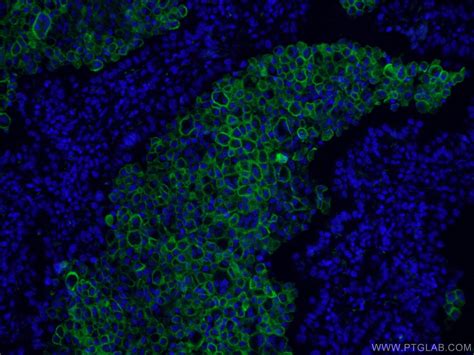 Cd206 Antibody Cl488 60143 Proteintech