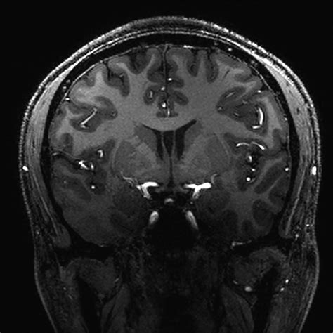 Low Versus Ultra High Field Mri How To Select Your Mri Fleet Applied Radiology