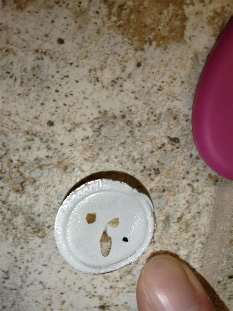 Is This Solid Evidence With Microscope Pictures Rbedbugs