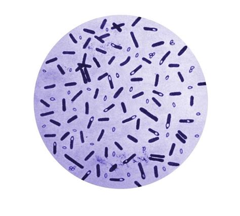Clostridium Botulinum What Is Botulism