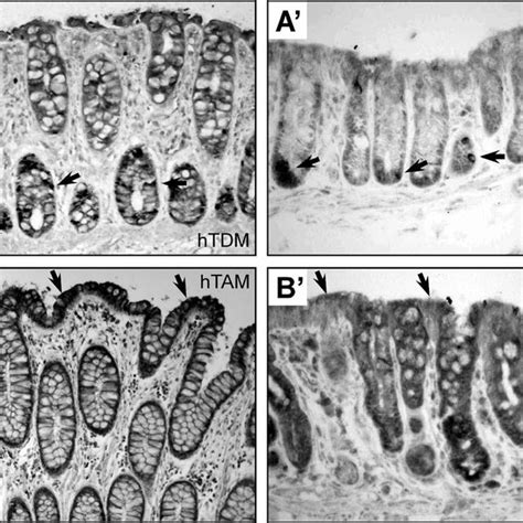 Immunohistochemical Staining For Survivin In Human A B And Mouse
