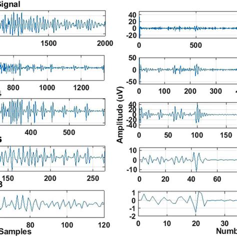 Proposed Methodology For The Classification Of Mi Eeg Signals Download Scientific Diagram
