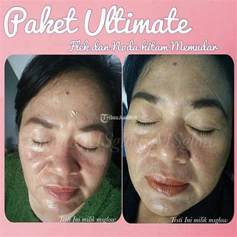 MS Glow Paket Ultimate ORI Pencerah Wajah Penghilang Noda Flek Hitam COD Di Surabaya Jawa Timur