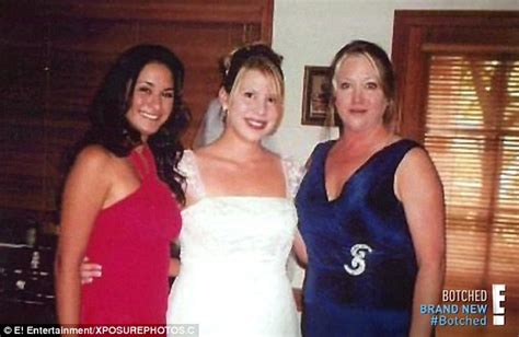 Mother Of Three Has Her Ski Slope Boobs Fixed After Botched Surgery