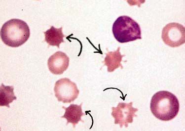 RBC Morphologies Images Flashcards Quizlet