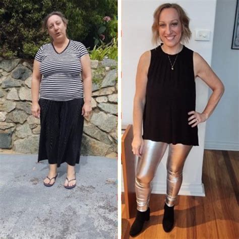 Bariatric Surgery Results From Real People In Perth