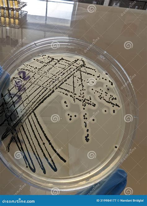 Quadrant Streak Of Staphylococcus Aureus On Baird Parker Agar Plate