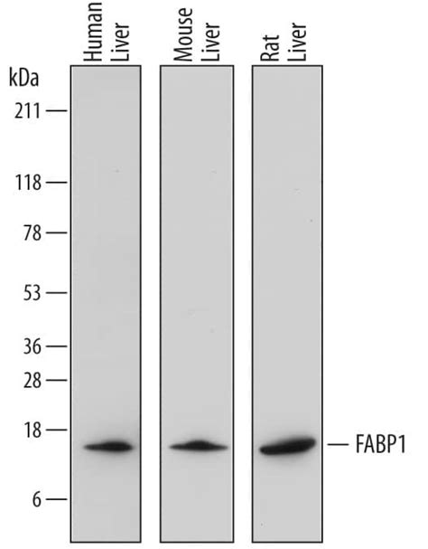 Humanmouserat Fabp1l Fabp Antibody Af7009 Randd Systems