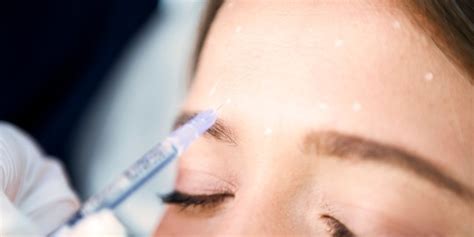 New Study Finds Botox Alters Brain Activity Kool Fm