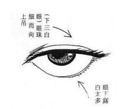 想做眼整形特别是提肌和下睑下至手术的要注意了小心下三白眼下睑退缩的先天性与后天性陷阱 知乎