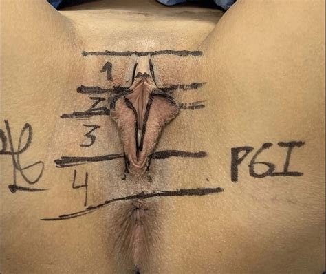 Topographic Markings Download Scientific Diagram