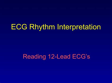 Introduction To 12 Lead Ecg The Art Of Interpretation Pdf Reduced Prices Th