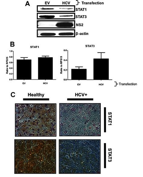 Loss Of Stat1 And Stat3 Protein In Hepatocytes And Liver Infiltrating