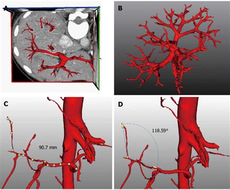 Vascular Tree Reconstruction Reconstruction Was Based On A Computed
