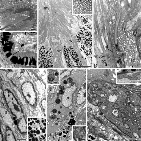 Light Microscopic A B And Transmission Electron Microscopic C H
