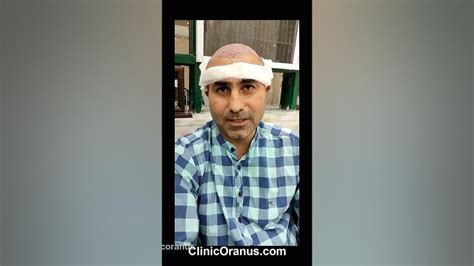 بهترین کلینیک کاشت مو در غرب تهران