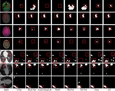 Slimmable Transformer With Hybrid Axial Attention For Medical Image Segmentation Pmc