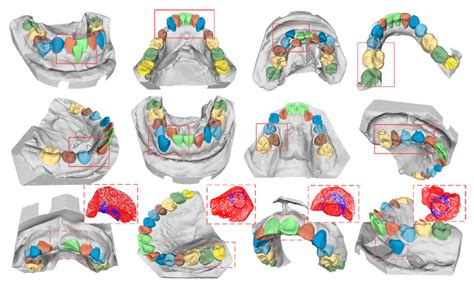 Tsegnet An Efficient And Accurate Tooth Segmentation Network On 3d