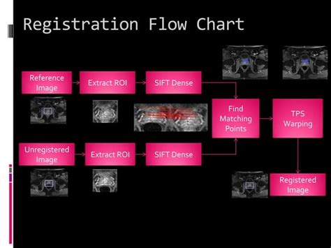 Post Processing Of Prostate Perfusion Mri Pptx Medical Tests