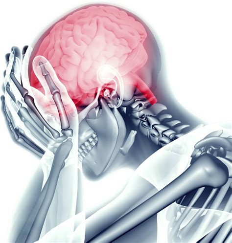 Proving Liability In A Traumatic Brain Injury Case Dallas Tx