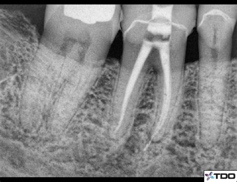 The More Tooth The Bettertri City Dev