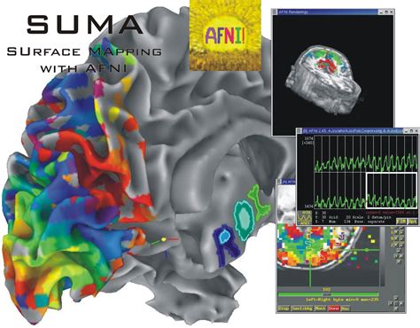 6 1 intro — afni suma and fatcat v25 2 05