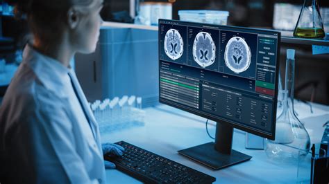 Avances En La Esclerosis Múltiple Y En Su Tratamiento Fem