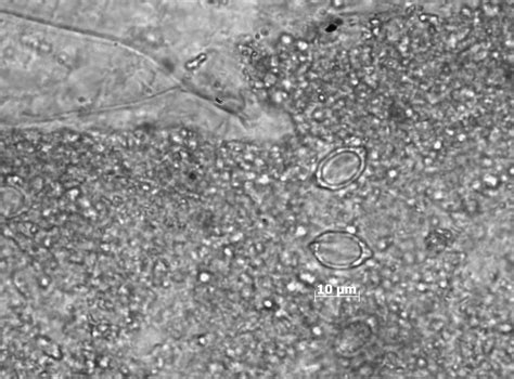 What Kind Of Microfossil It Is Researchgate
