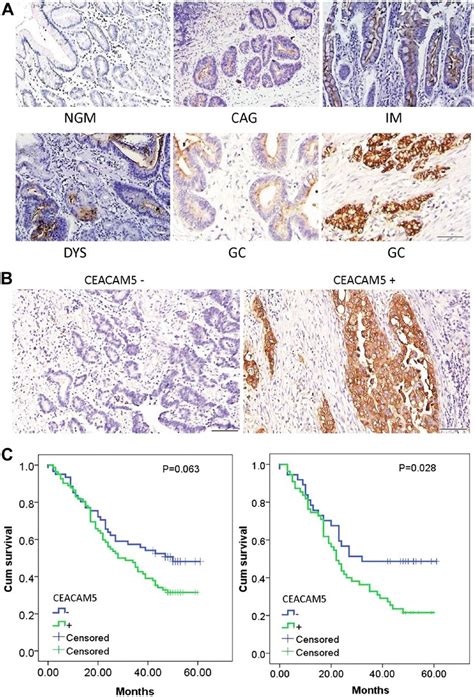 A Representative IHC Staining Of CEACAM In Different Gastric Download Scientific Diagram