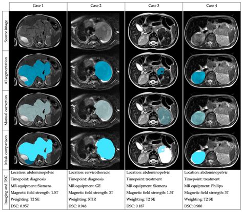 Examples Of The Automatic Segmentation Masks Before And After Manual Download Scientific