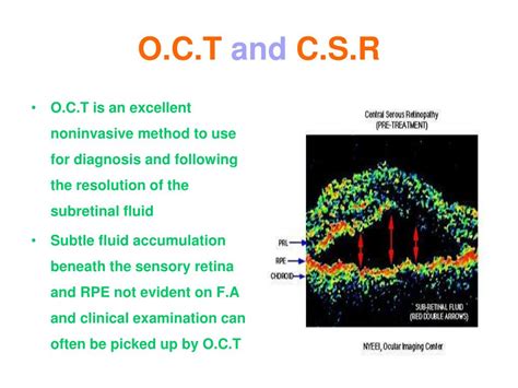 Csr Oct