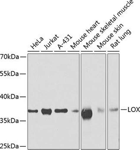 Anti Lox 항체 Cab7698 Assay Genie