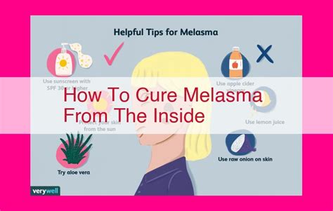 Unveiling Melasmas Cure From Within Hormonal Balance And Nutritional