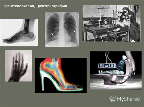 Презентация на тему Рентгенови лъчи Рентгеновите лъчи били открити на