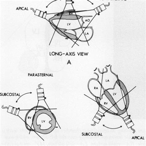 Diagram Ofthe Two Dimensional Echocardiographic Imaging Planes