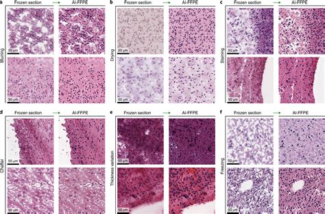 Improvement Of Artefacts In The Brain Frozen Sections Examples Of Download Scientific Diagram