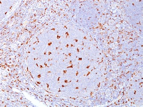 Cd68 Macrophage Marker Antibody Clone C68 684 Gene Id 968