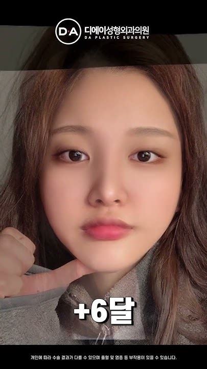 분위기 반전 쩔지 윤곽3종 후기 코성형 전후 Youtube