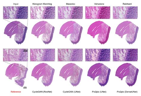 Staining Normalization In Histopathology Method Benchmarking Using