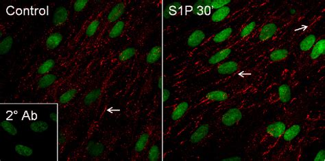 Actomyosin Structure Organization Semantic Scholar