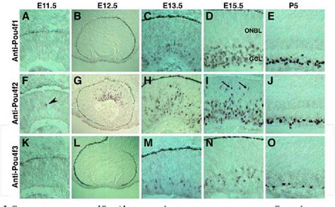 Figure 2 From Molecular Control Of Retinal Ganglion Cell Specification And Differentiation