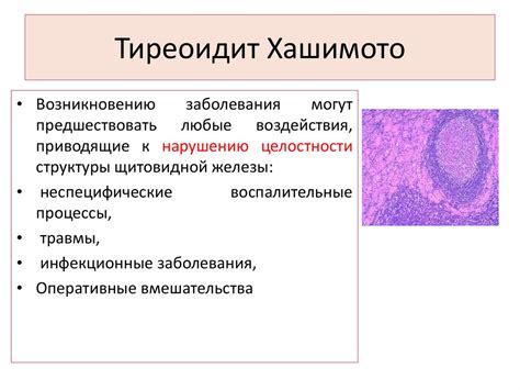 Аутоиммунные заболевания презентация онлайн
