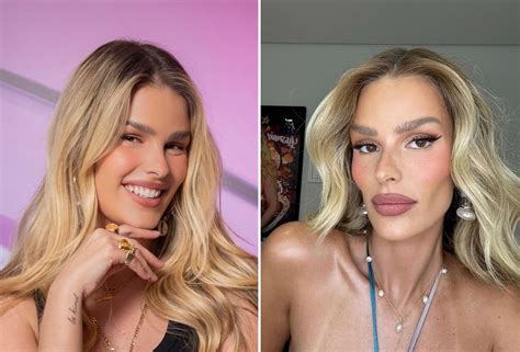 Yasmin Brunet desabafa e se explica após críticas a seu rosto Quem