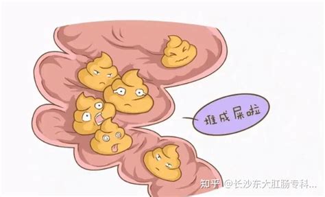 长沙东大肛肠医院科普为什么很多上班族会便秘 知乎